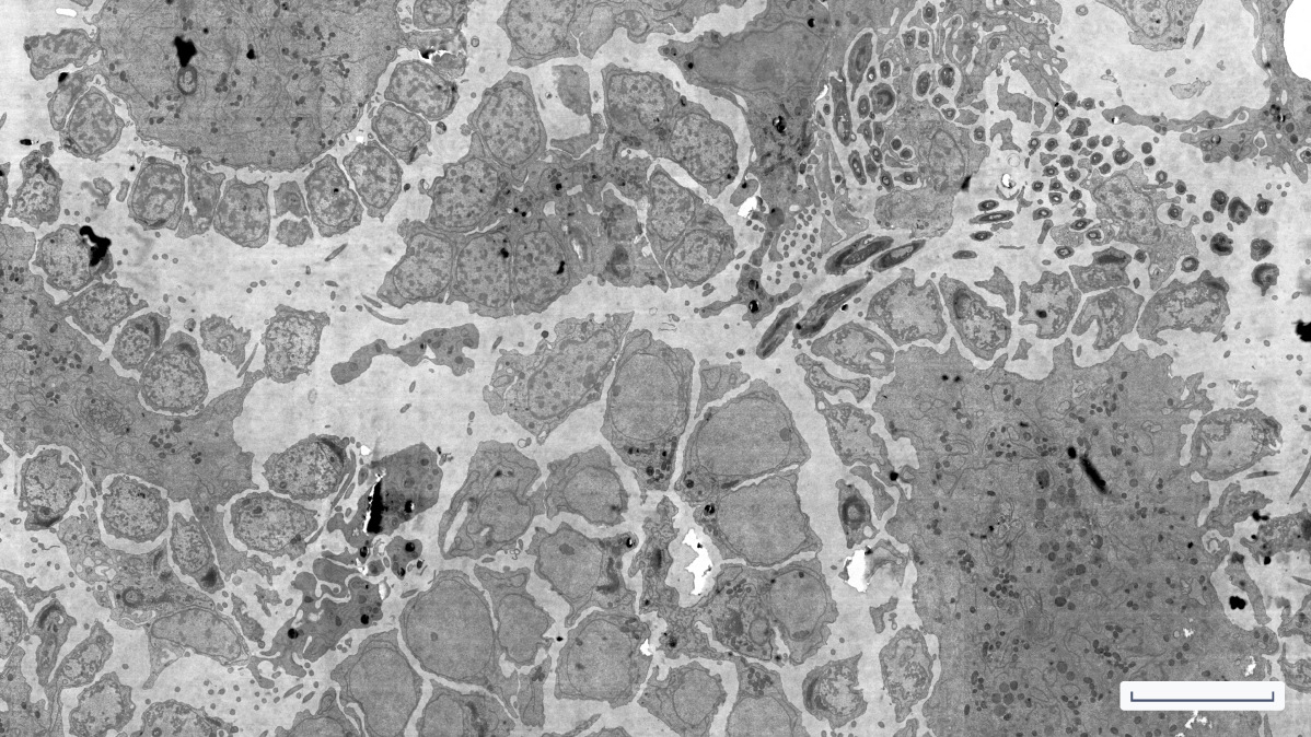 FAST-EM | Ultra-fast automated multibeam electron microscope